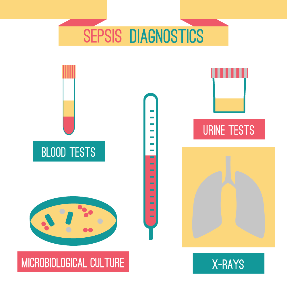 Hospitals Take The Lead In Sepsis Fight Hoosier Hospitals